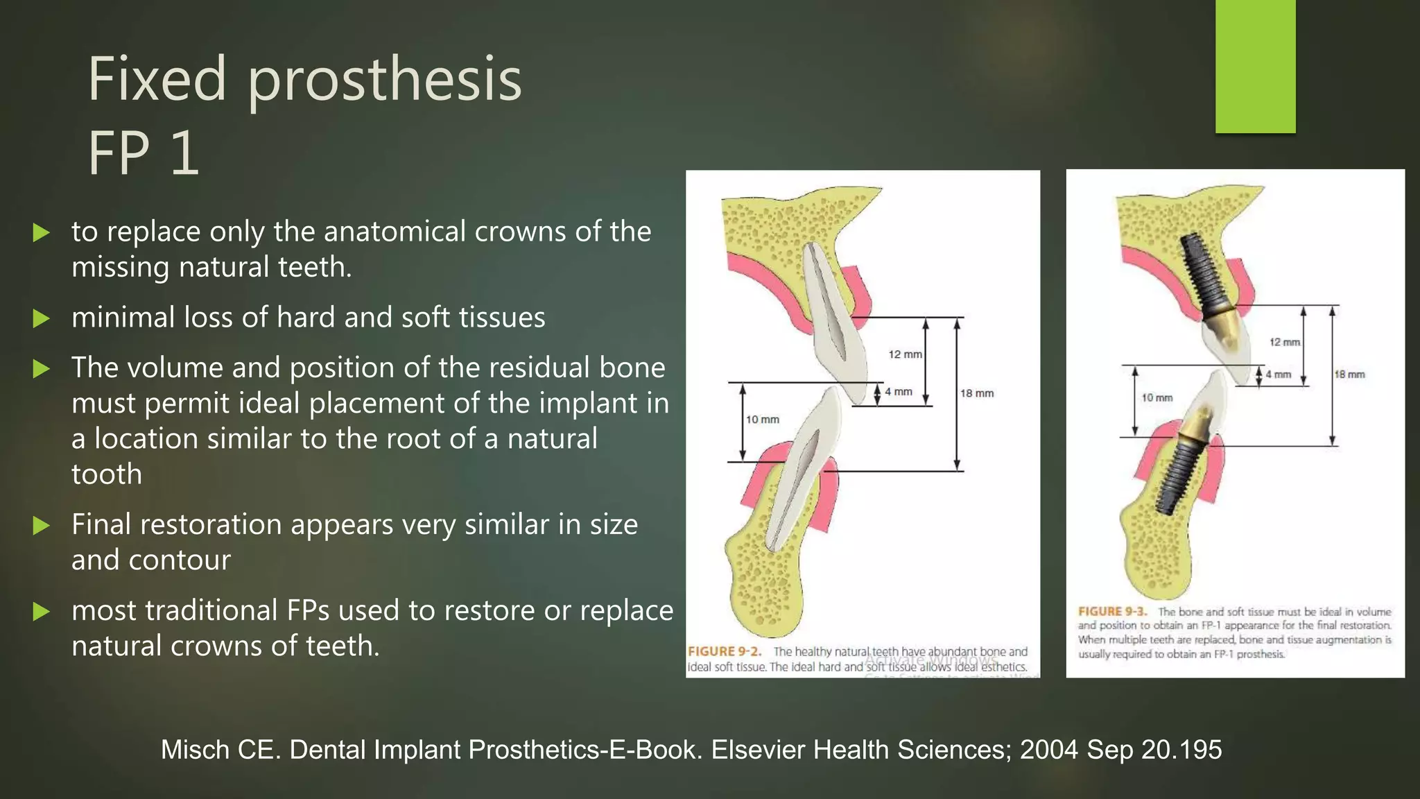 Prosthetic options in implant dentistry | PPTX