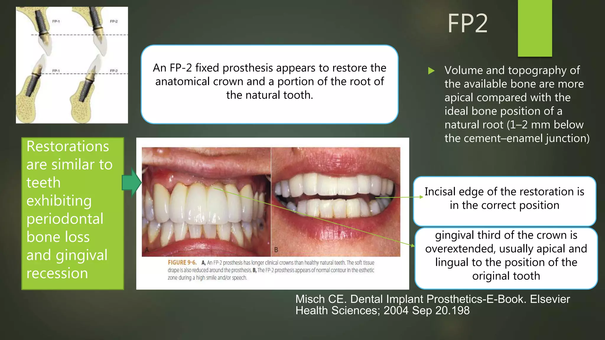 Prosthetic options in implant dentistry | PPTX