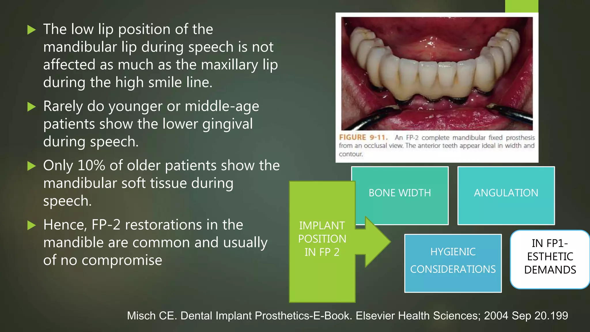 Prosthetic options in implant dentistry | PPTX