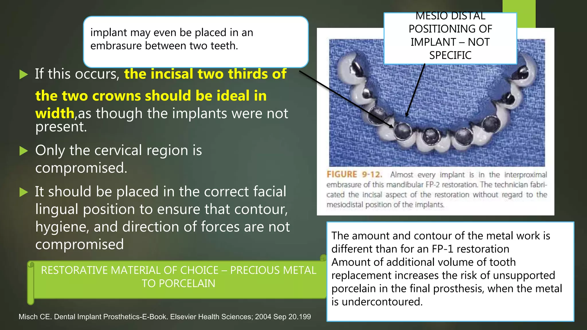 Prosthetic options in implant dentistry | PPTX