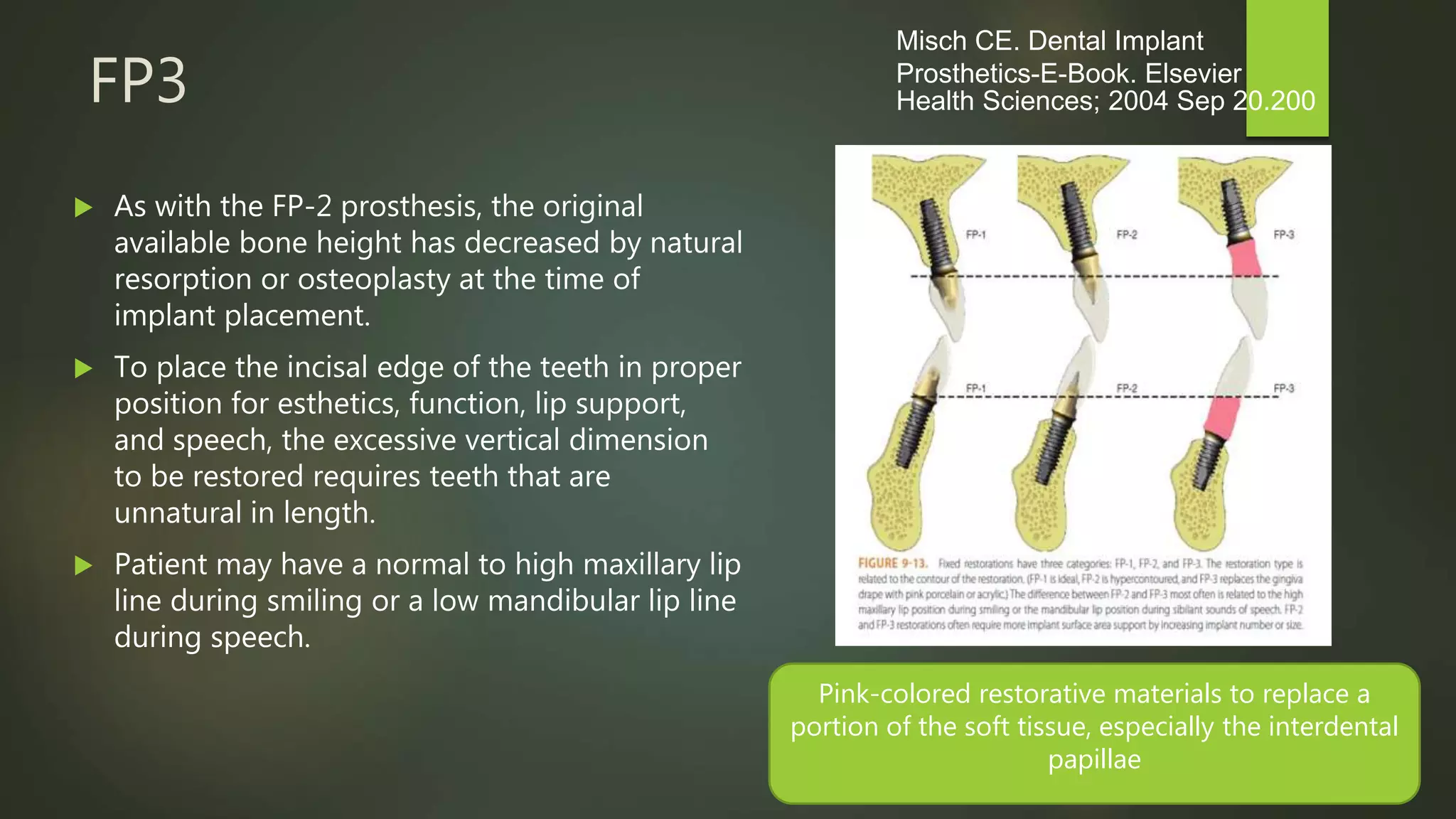 Prosthetic options in implant dentistry | PPTX