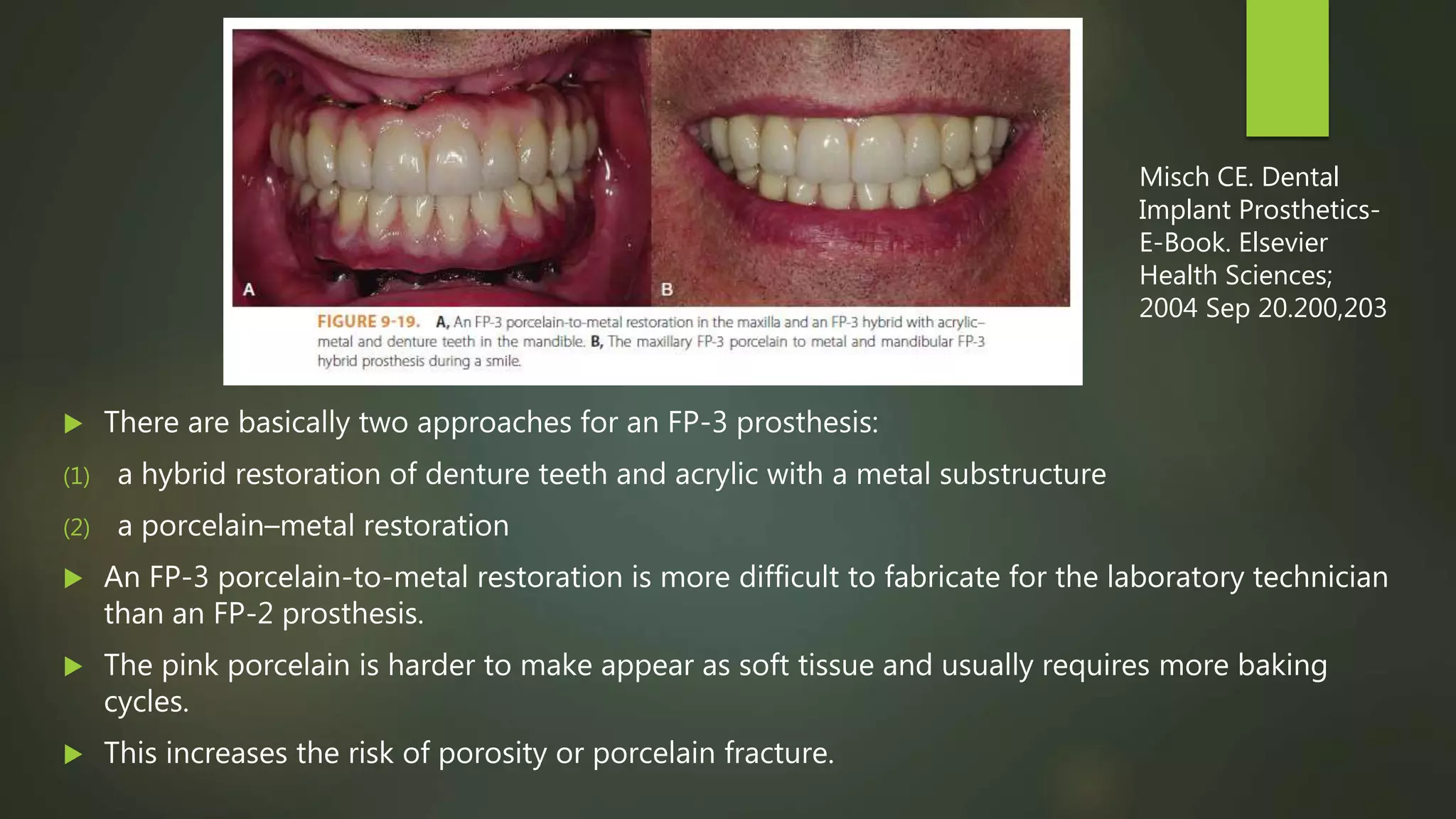 Prosthetic options in implant dentistry | PPTX