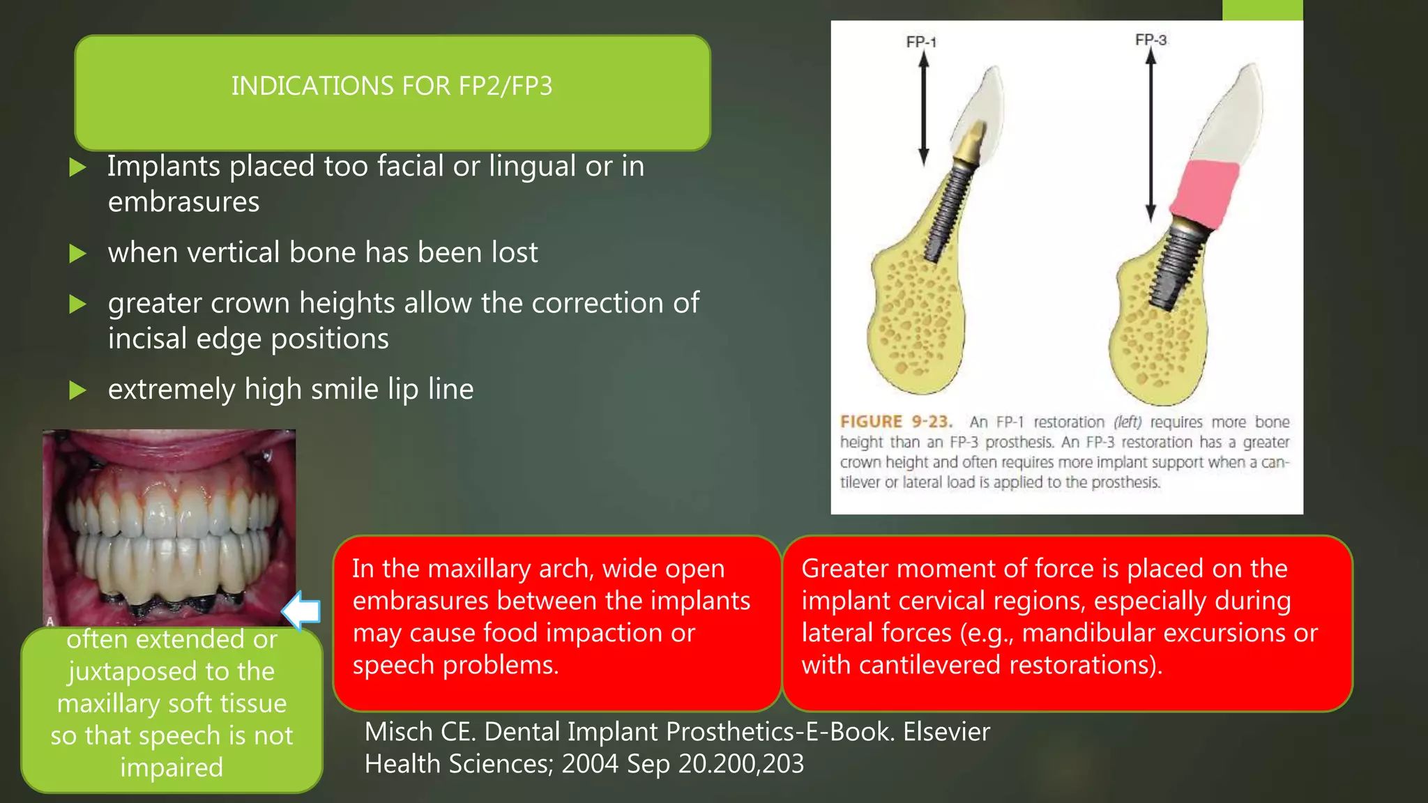 Prosthetic options in implant dentistry | PPTX