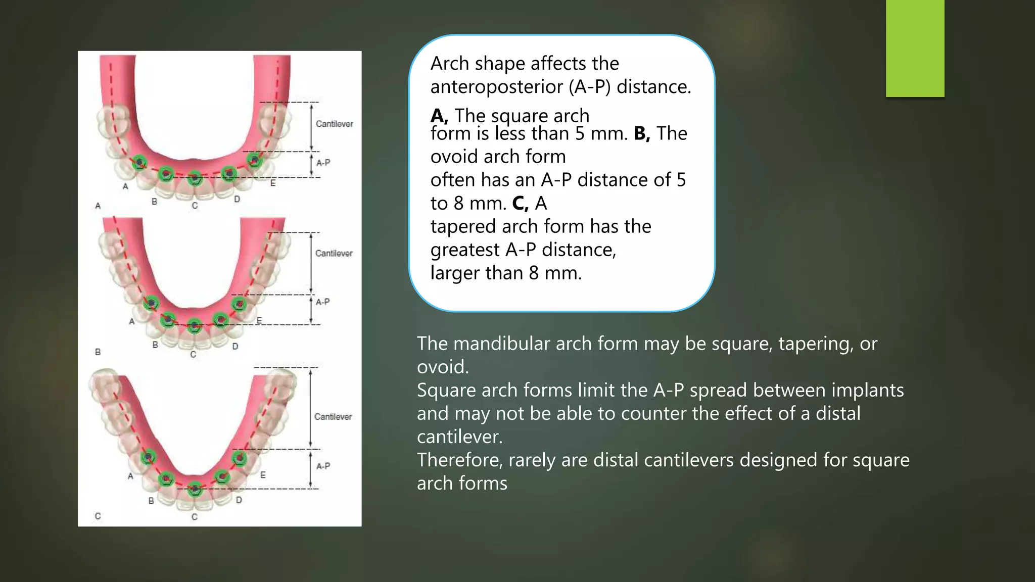 Prosthetic options in implant dentistry | PPTX