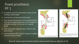 Prosthetic options in implant dentistry | PPTX