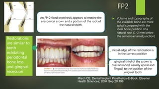 Prosthetic options in implant dentistry | PPTX