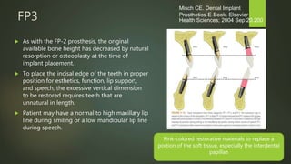 Prosthetic options in implant dentistry | PPTX