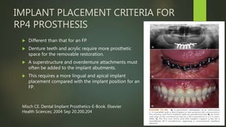 Prosthetic options in implant dentistry | PPTX