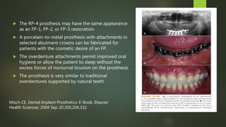 Prosthetic options in implant dentistry | PPTX