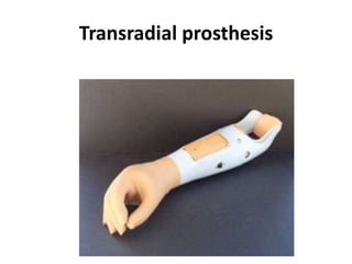 Prosthetics | PPTX