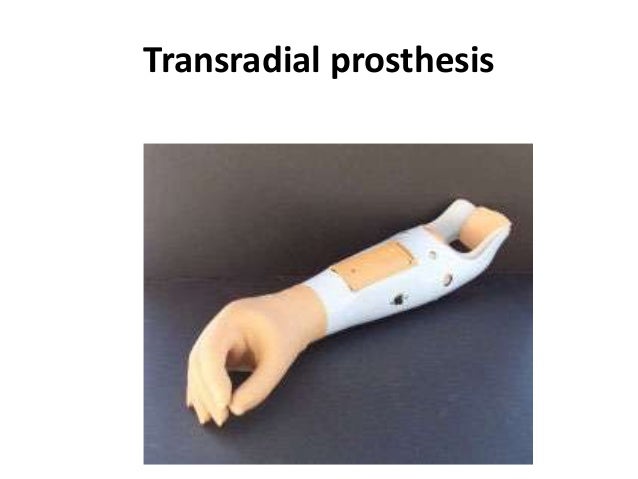 Prosthetics