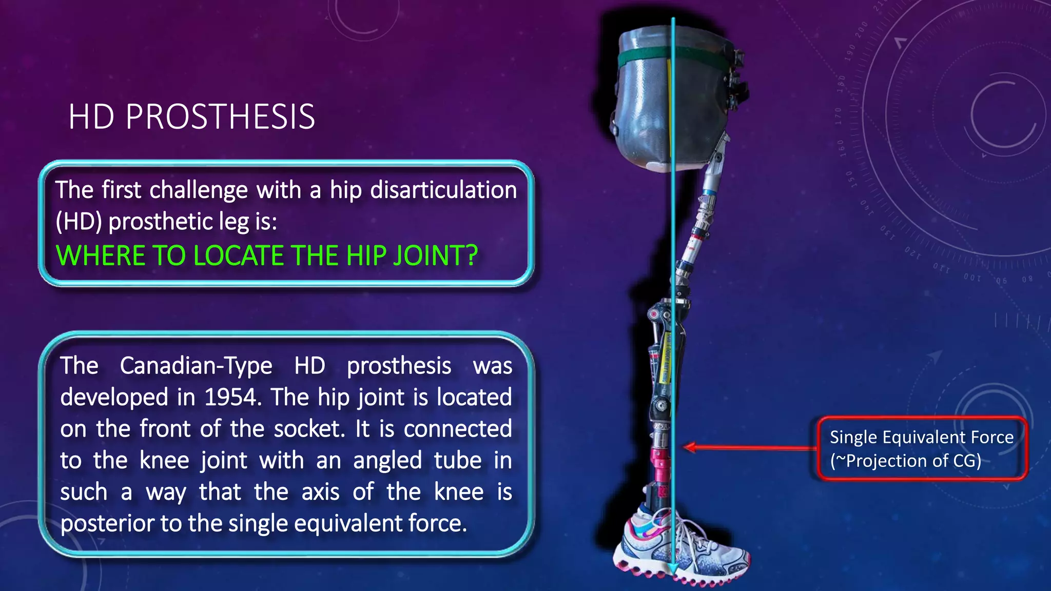 PROSTHESIS FOR HIP DISARTICULATION AMPUTEES - STUDY | PPSX