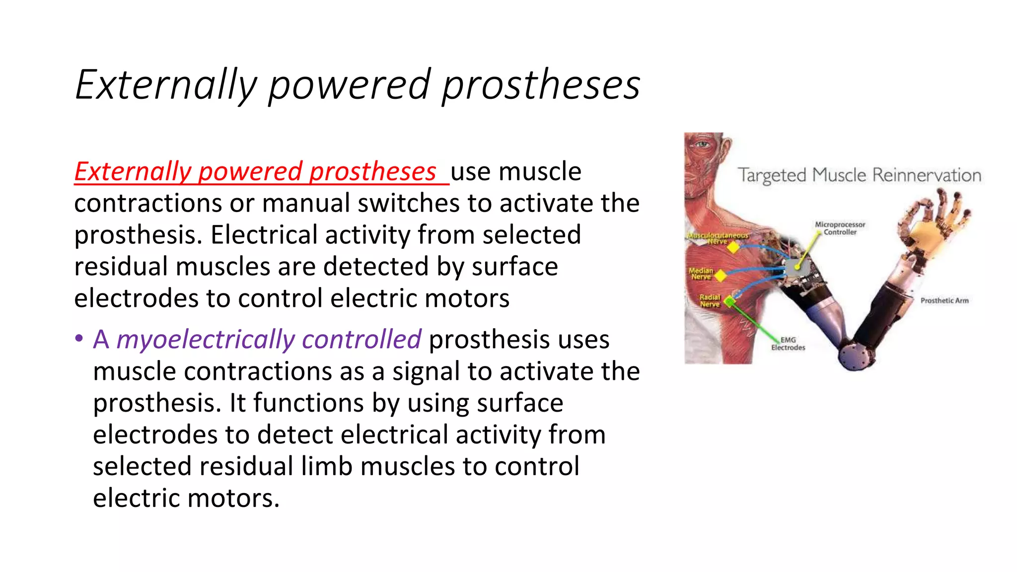 Prosthetics | PPTX
