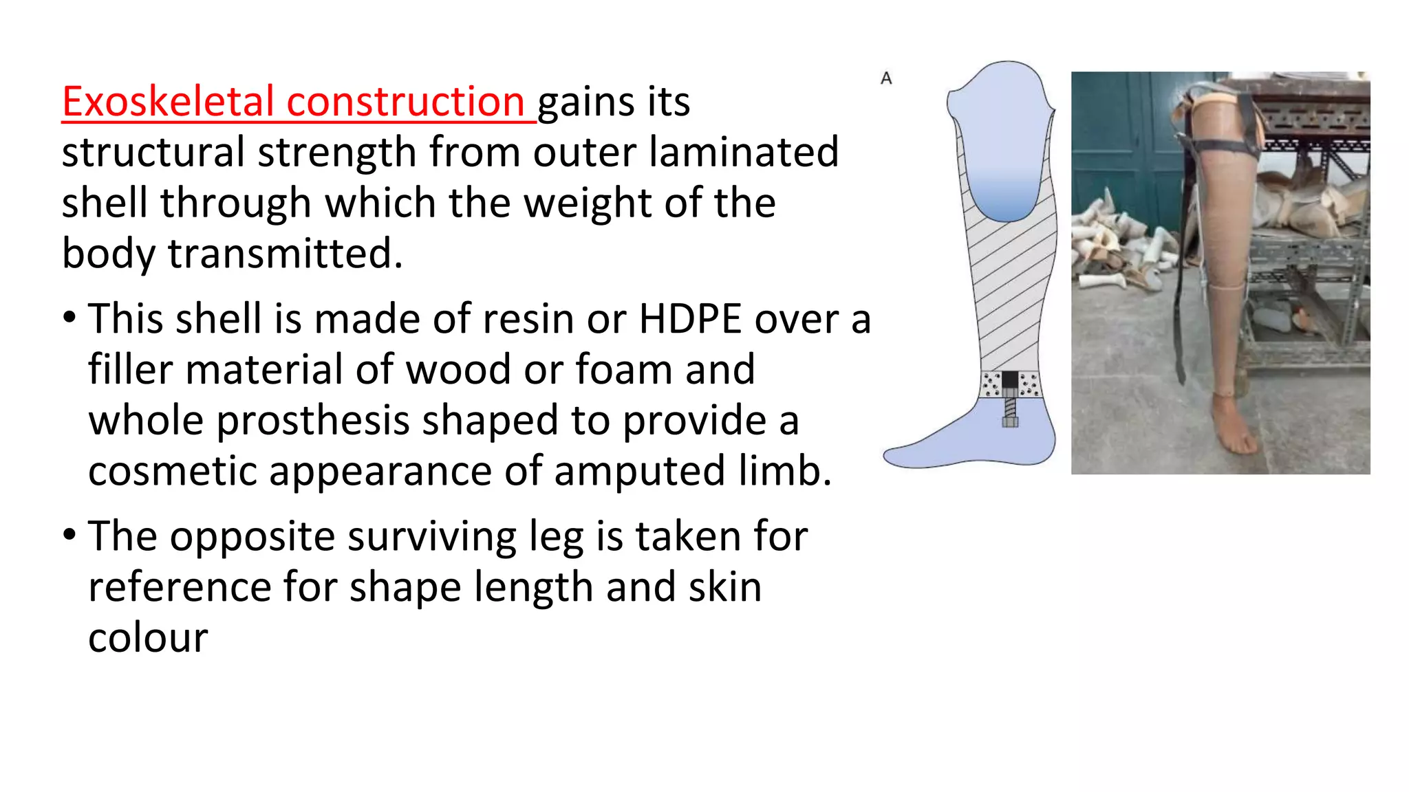 Prosthetics | PPTX