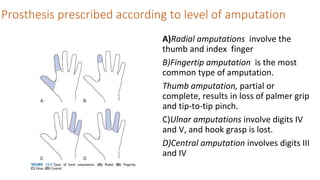 Prosthetics | PPTX