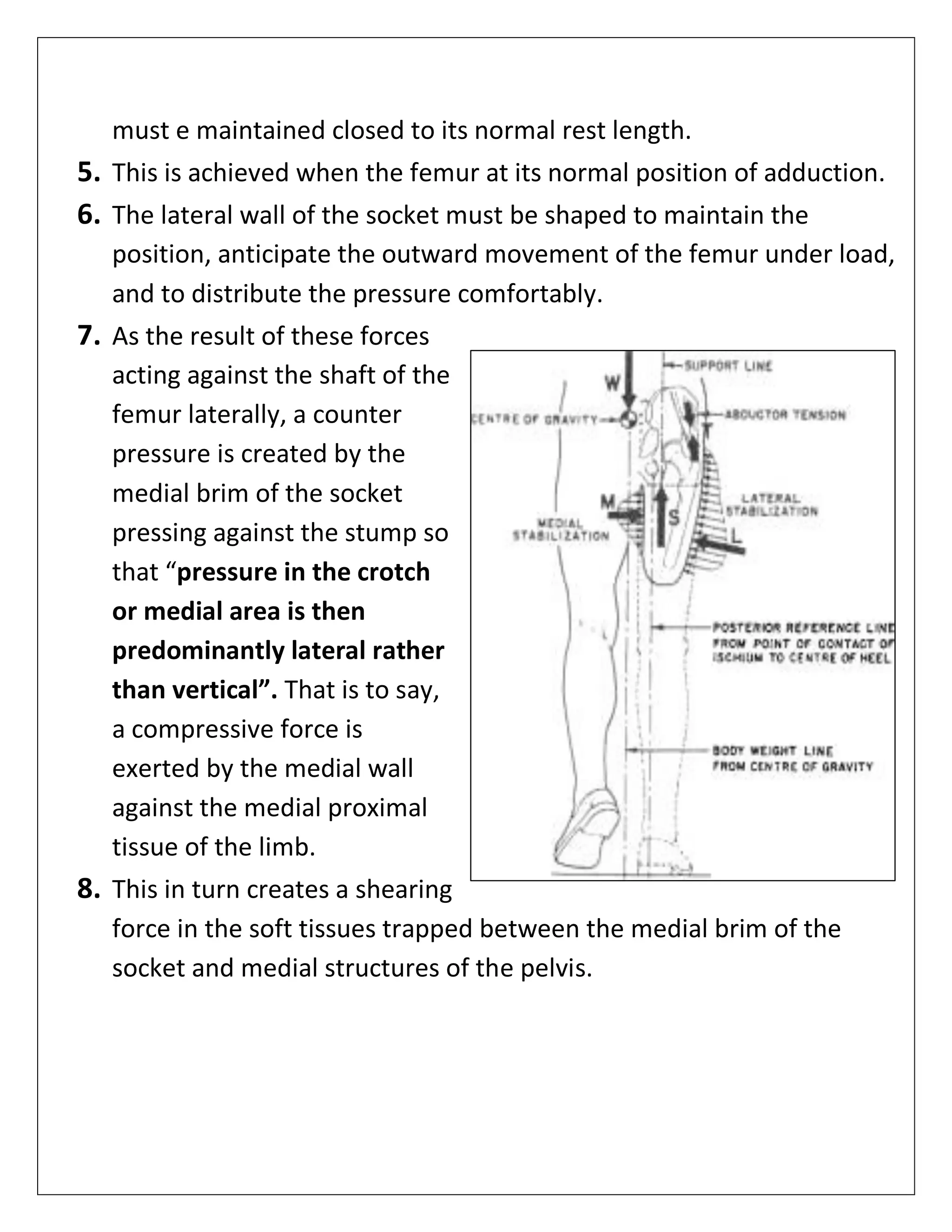 Transfemoral Prosthesis- Suspension, Socket Design | PDF