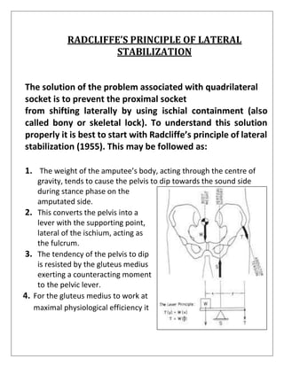 Transfemoral Prosthesis- Suspension, Socket Design | PDF