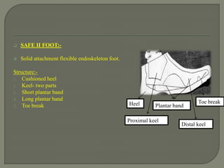 Prosthetics foot | PDF