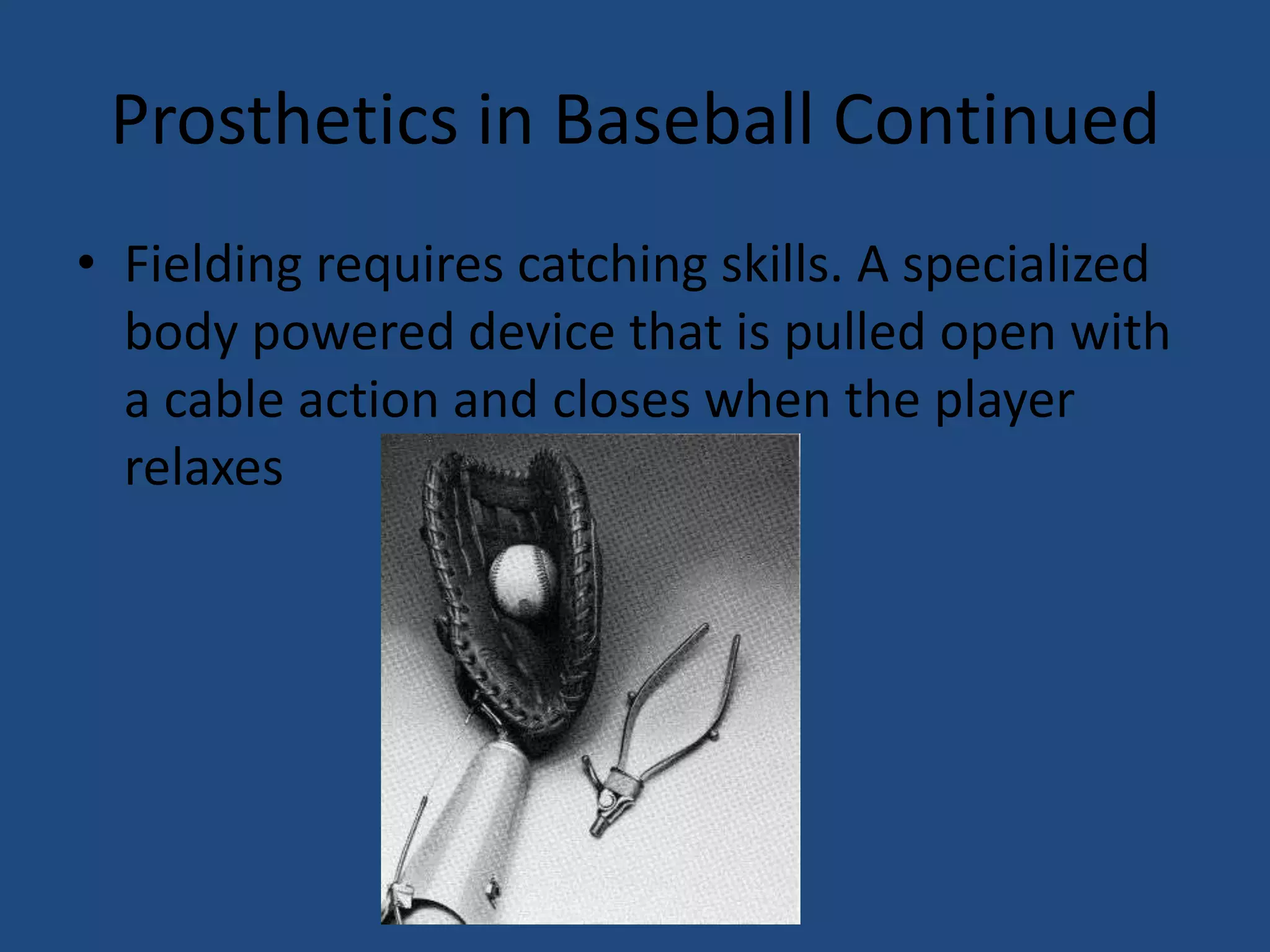Prosthetics in sports | PPTX
