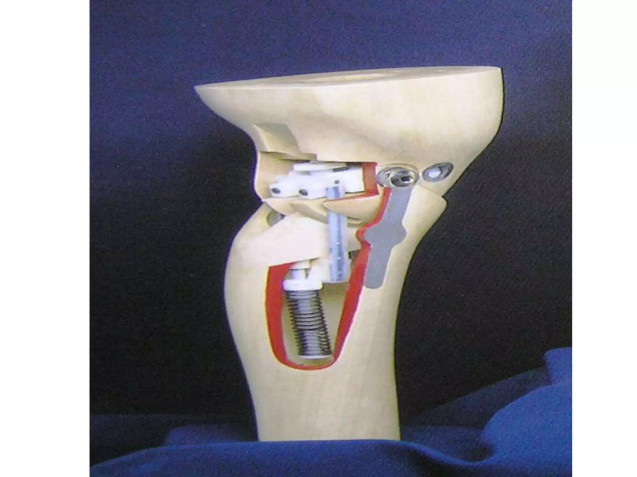 PROSTHETICS KNEE JOINTS.ppt