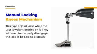 Tans femoral Amputee : Prosthetics Knee Joints.pptx