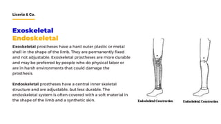 Tans femoral Amputee : Prosthetics Knee Joints.pptx