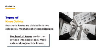 Tans femoral Amputee : Prosthetics Knee Joints.pptx