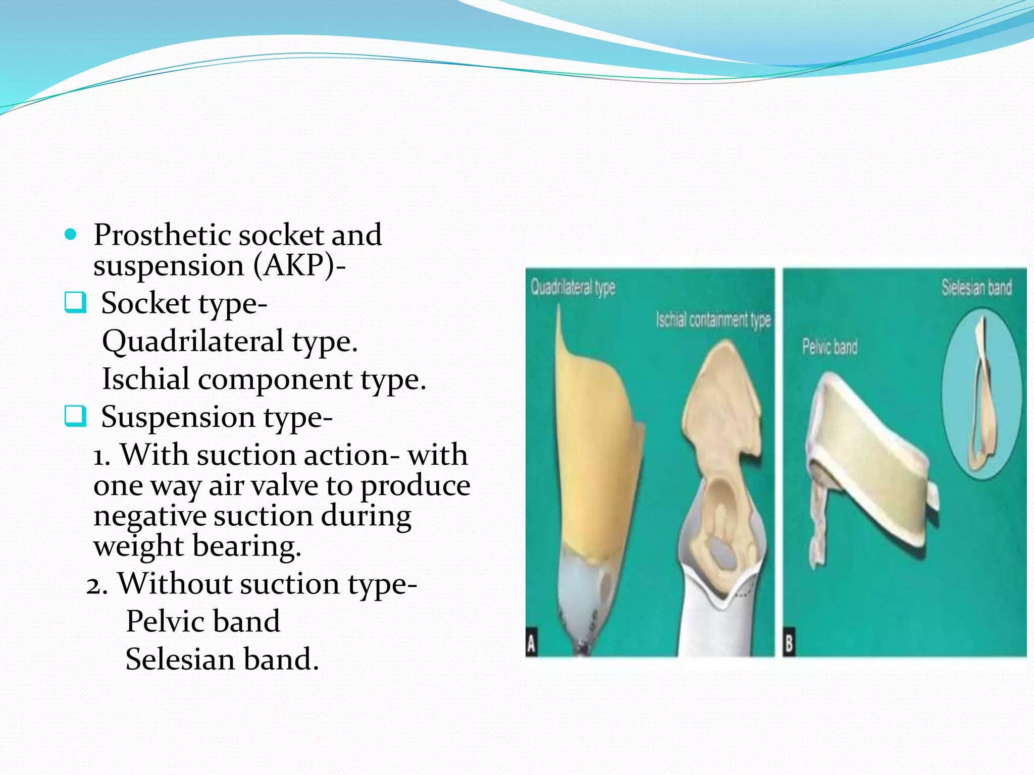 Prosthetics, orthotics and traction | PPTX