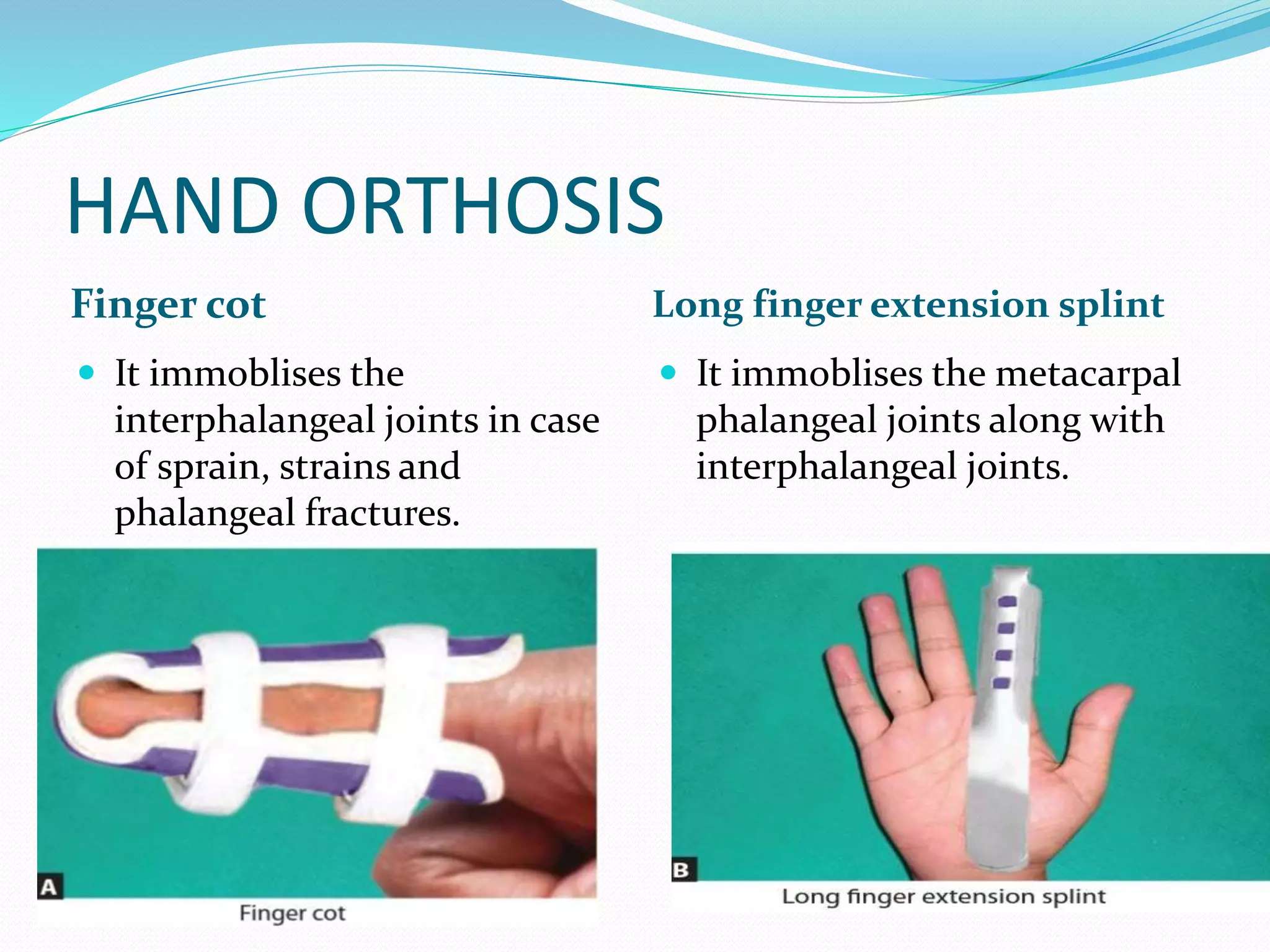 Prosthetics, orthotics and traction | PPTX