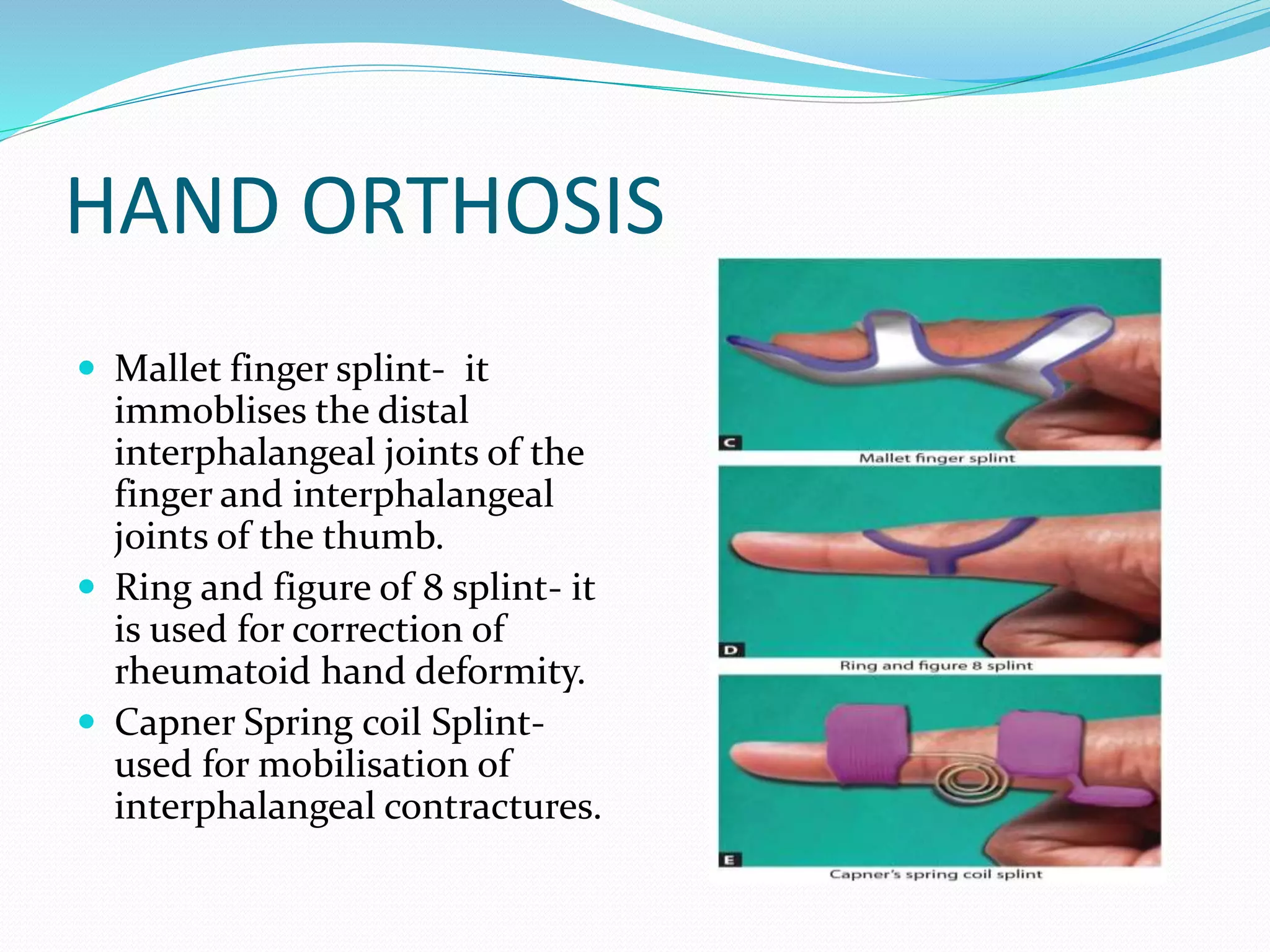 Prosthetics, orthotics and traction | PPTX