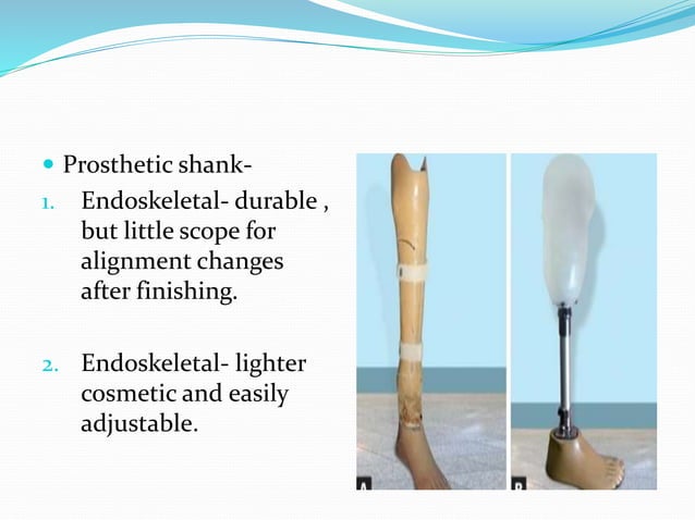 Prosthetics, orthotics and traction | PPTX