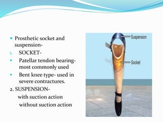 Prosthetics, orthotics and traction | PPTX