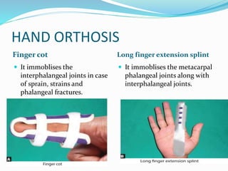 Prosthetics, orthotics and traction | PPTX