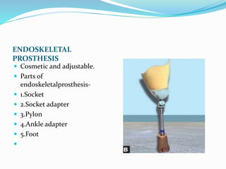 Prosthetics, orthotics and traction | PPTX