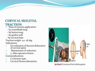 Prosthetics, orthotics and traction | PPTX