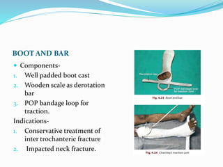 Prosthetics, orthotics and traction | PPTX