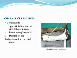 Prosthetics, orthotics and traction | PPTX