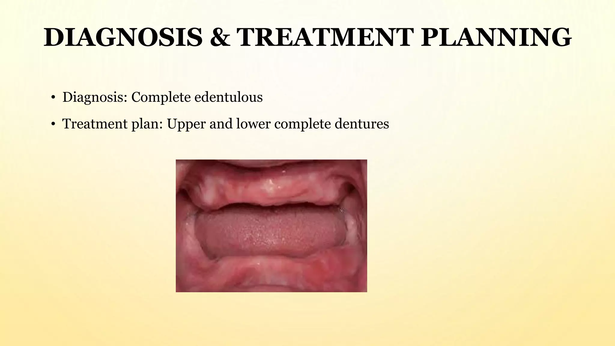 clinical & laboratory step in complete denture | PPTX
