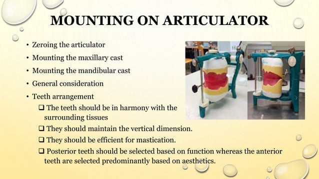 clinical & laboratory step in complete denture | PPTX