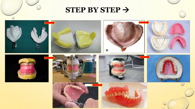 clinical & laboratory step in complete denture | PPTX