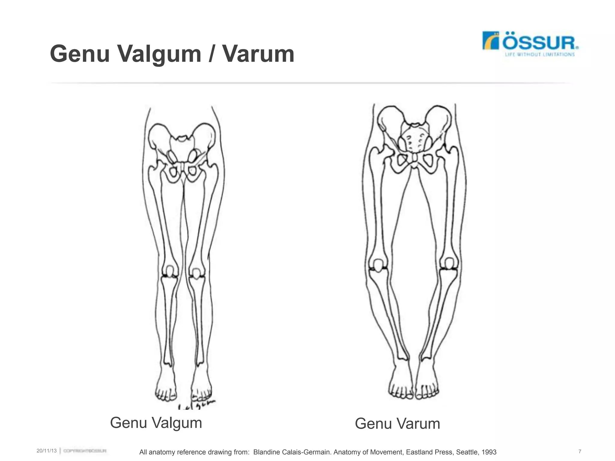 Basic Prosthetics II | PPTX