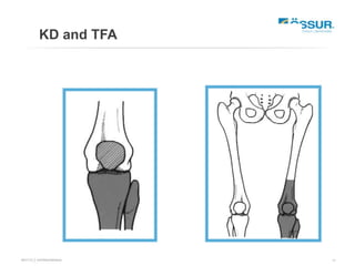 Basic Prosthetics II | PPTX