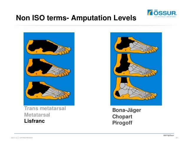 Basic Prosthetics II