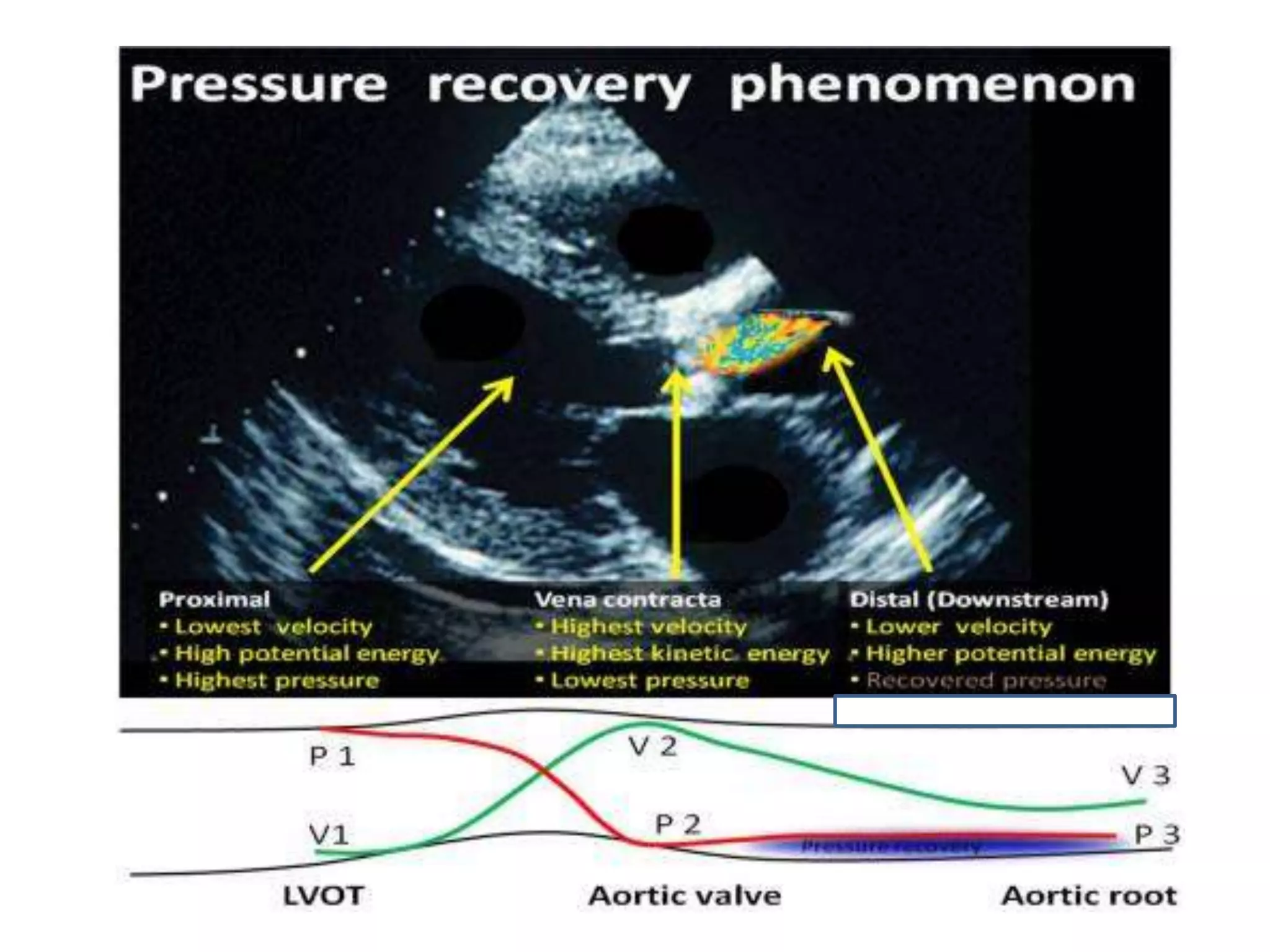 PROSTHETIC_VALVE_ECHO_ASSESSMENT_DR_SANTHOSH_CALICUTcardioSRcom.pptx