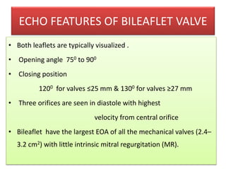 PROSTHETIC_VALVE_ECHO_ASSESSMENT_DR_SANTHOSH_CALICUTcardioSRcom.pptx