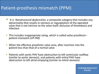 Prosthetic valve evaluation gaurav | PPTX