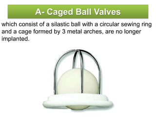 Prosthetic cardiac valves | PPTX
