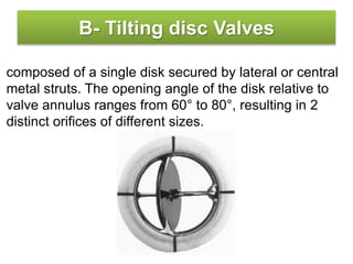 Prosthetic cardiac valves | PPTX