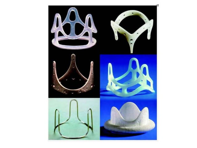 Prosthetic cardiac valves | PPTX