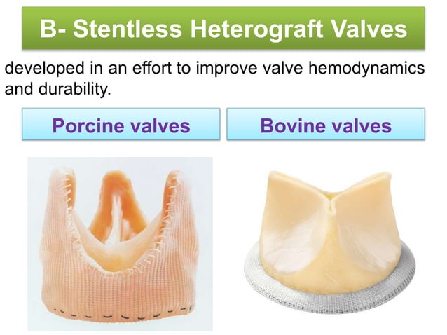 Prosthetic cardiac valves | PPTX